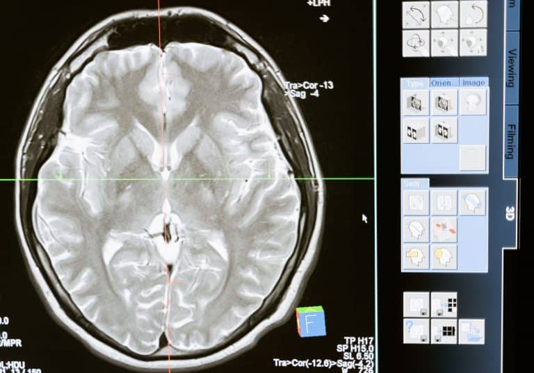 Oponiak | ZdalnaPrzychodnia.pl
